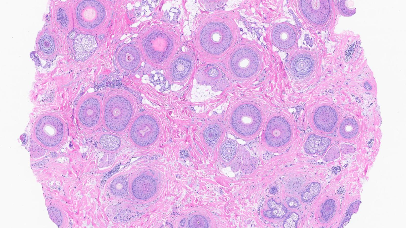 Dermatopathology Fellowship | Columbia University Department of Dermatology